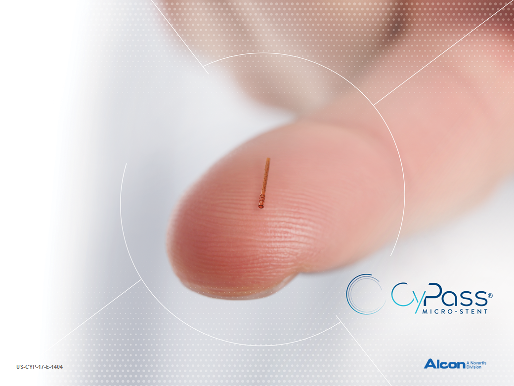 The Golden Rule of Glaucoma Treatment (and eye care!) - West Georgia ...